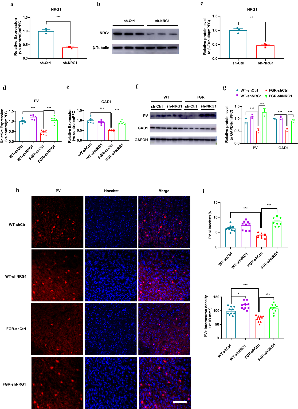 Cell Death Discovery ︱康九红团队发现NRG1有望成为宫内生长受限导致的精神分裂症的治疗新靶点
