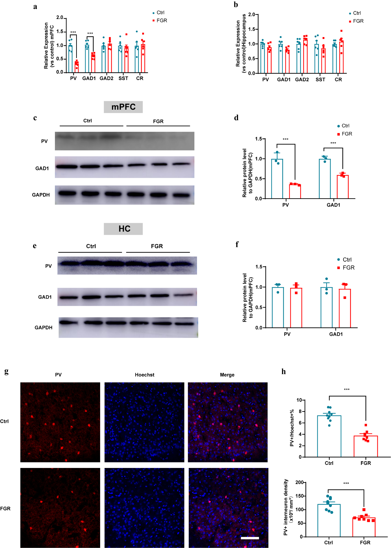 Cell Death Discovery ︱康九红团队发现NRG1有望成为宫内生长受限导致的精神分裂症的治疗新靶点