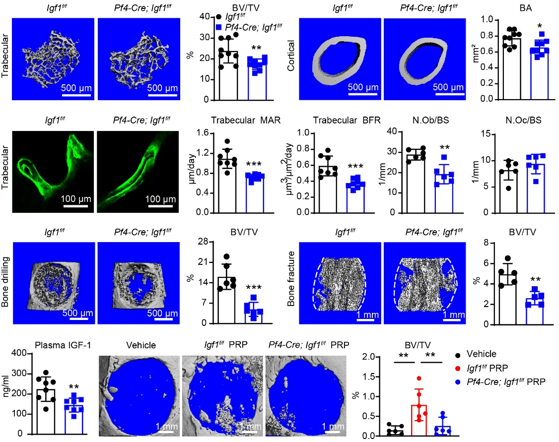 PNAS |岳锐课题组揭示骨髓来源IGF-1调控成体骨骼维持与损伤修复