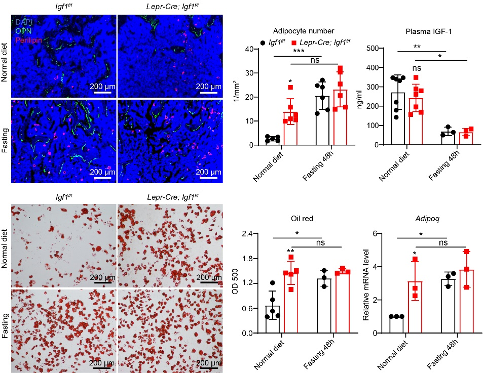 PNAS |岳锐课题组揭示骨髓来源IGF-1调控成体骨骼维持与损伤修复