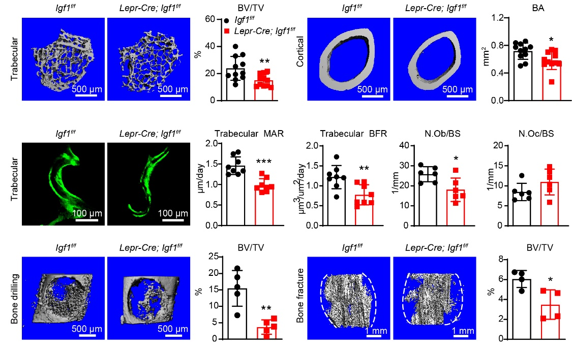 PNAS |岳锐课题组揭示骨髓来源IGF-1调控成体骨骼维持与损伤修复